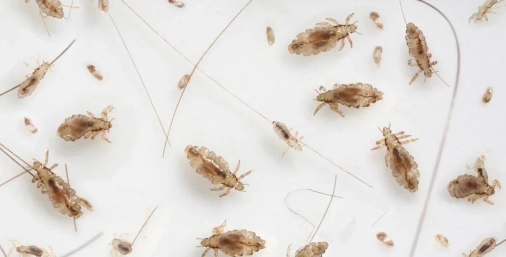 When is Lice Season? You May Be Surprised by Our Answer